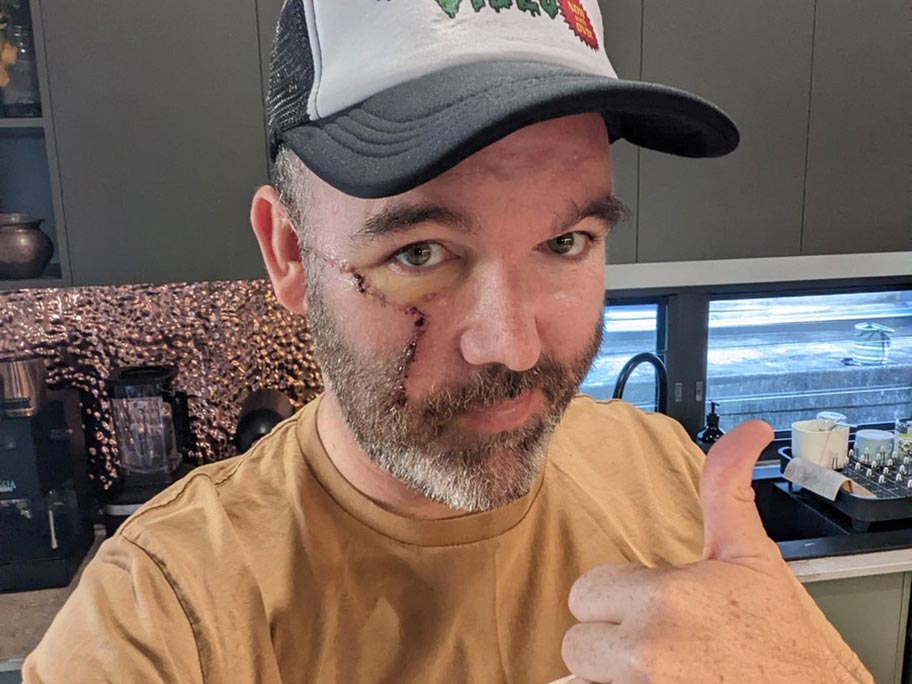 'This email could save your life': GP diagnoses melanoma while watching ...