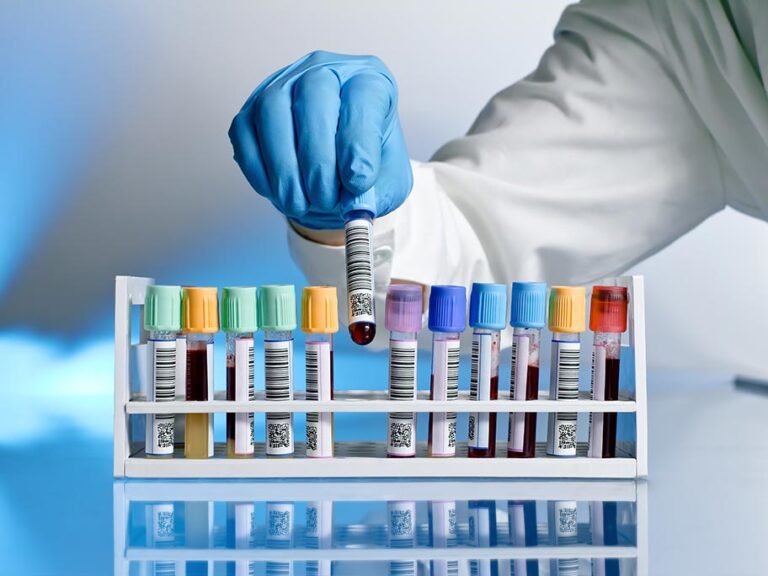 'Nudge letters' reduced GP pathology requests by 42,000 a year: Lancet ...