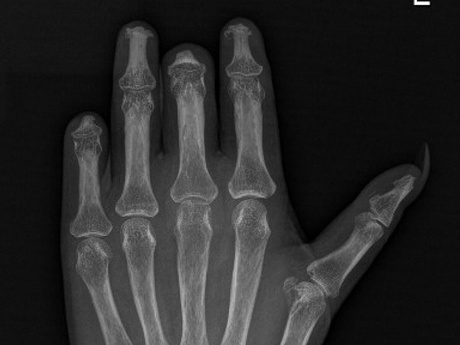 Spot Dx — What’s behind these stiff digits? | AusDoc