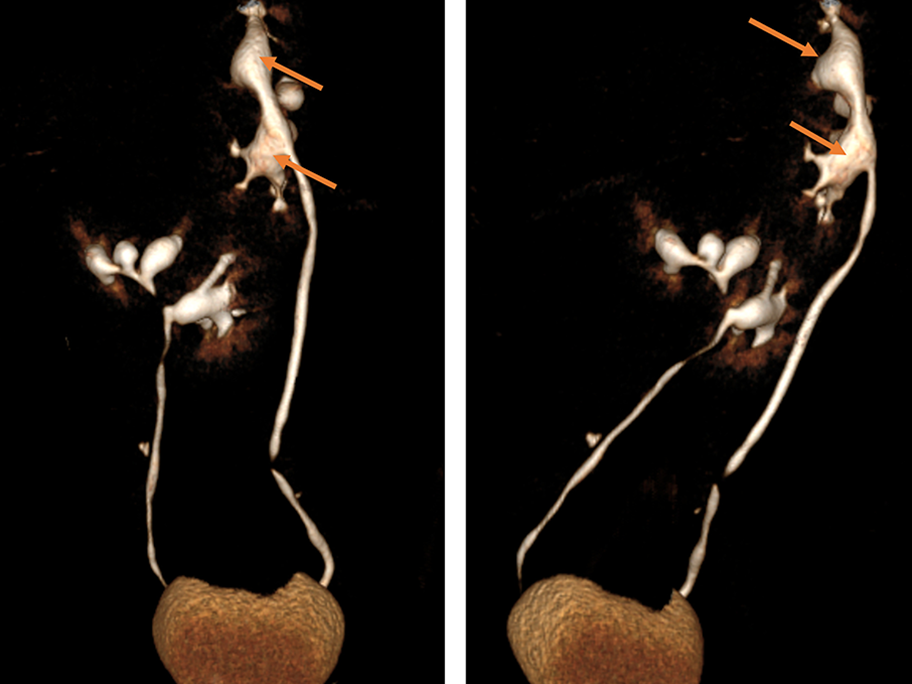 Medical Must-See: Rare renal triple take | AusDoc