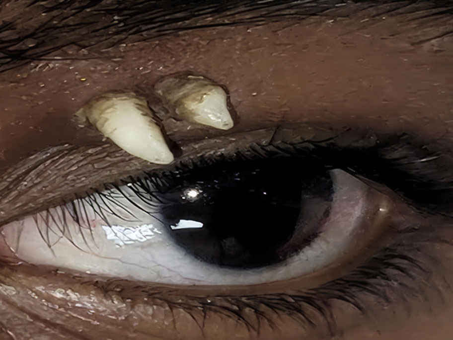 Medical Must-See: Doctors eye an ectopic tooth | AusDoc